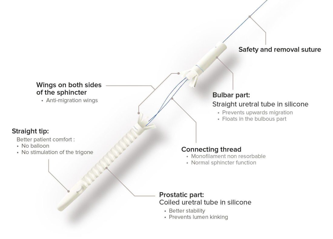 Urologie - Benigne Prostaat Hyperplasie